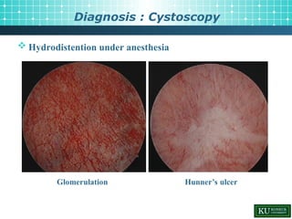 9th-sym-15painfulbladdersyndromepppt.ppt