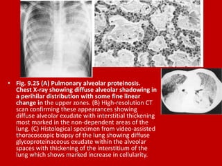 9 the paediatric chest | PPTX