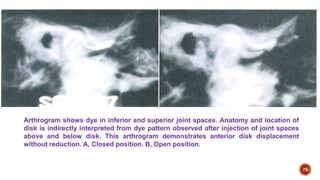 Lecture 9 TMJ anatomy examination | PPTX