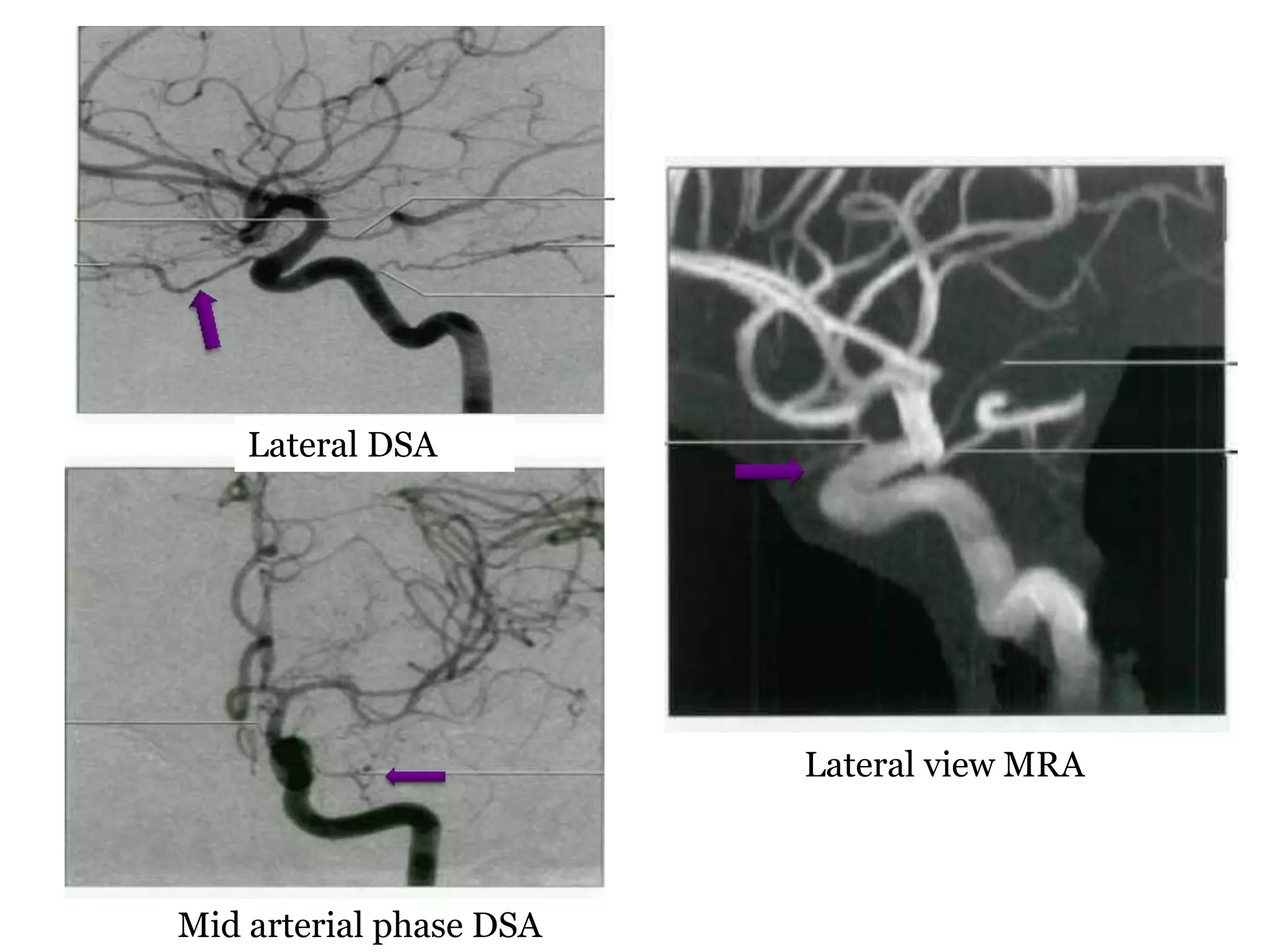 Vascular brain anatomy for Radiology by Dr Soumitra Halder | PPTX