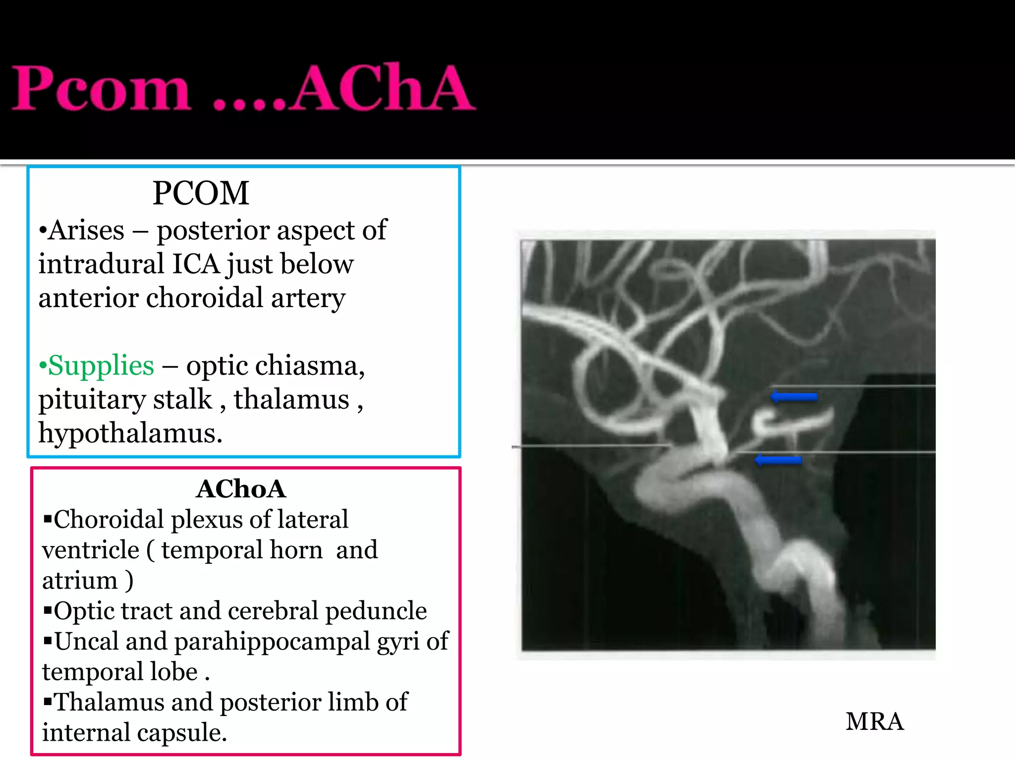 Vascular brain anatomy for Radiology by Dr Soumitra Halder | PPTX