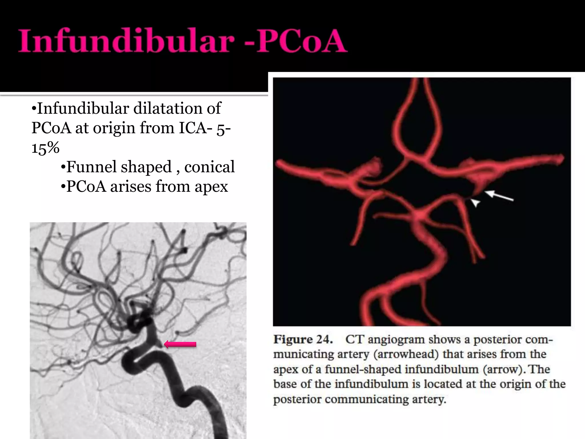 Vascular brain anatomy for Radiology by Dr Soumitra Halder | PPTX