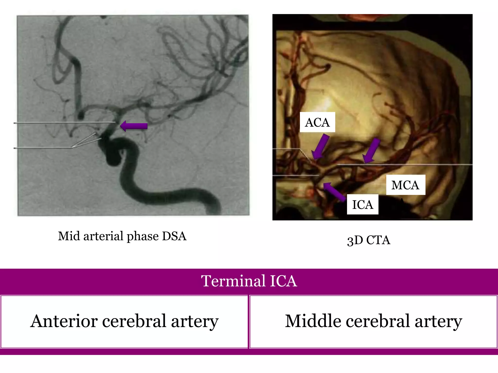 Vascular brain anatomy for Radiology by Dr Soumitra Halder | PPTX