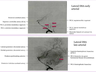 Vascular brain anatomy for Radiology by Dr Soumitra Halder | PPTX