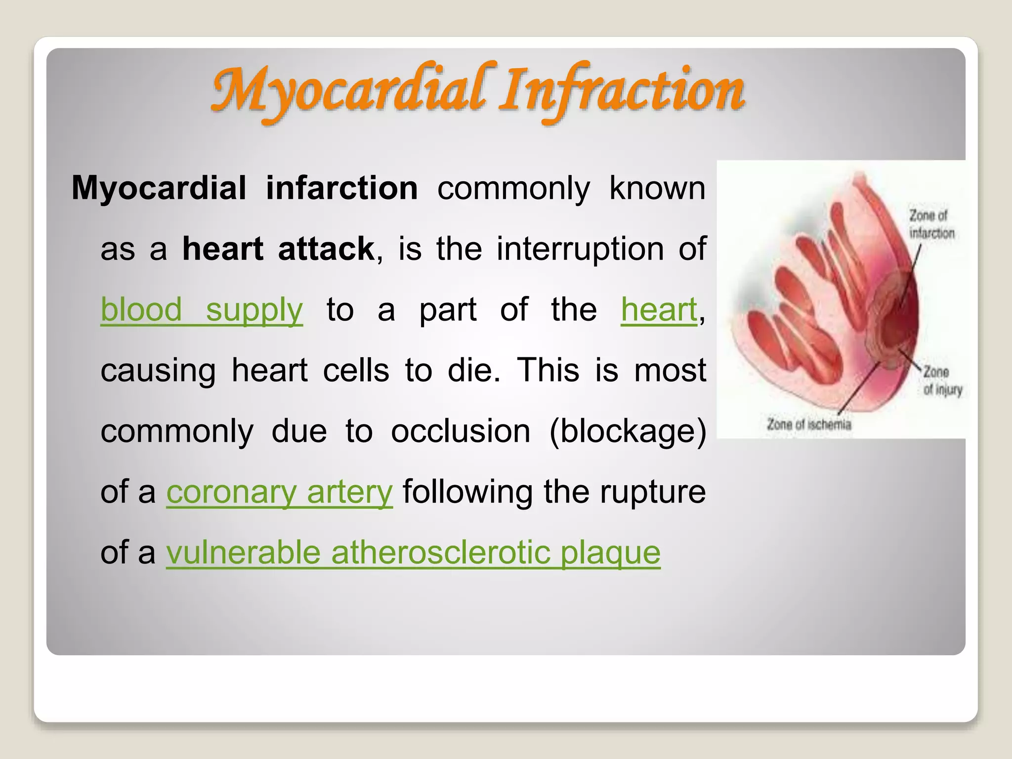 Myocardial infraction presentation | PPTX