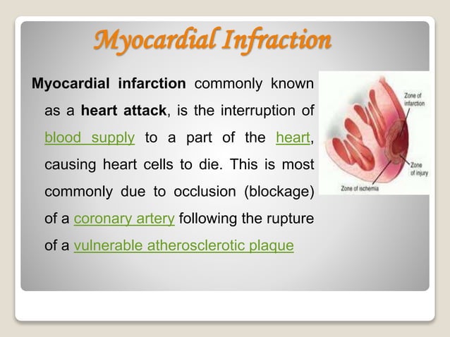 Myocardial infraction presentation | PPTX