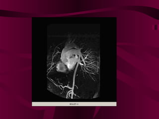 055 mri applications in cardiovascular medicine | PPT