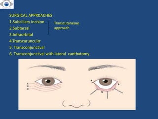 BLOW_OUT_FRACTURE_(1) presentation dhir hospital bhiwani.pptx