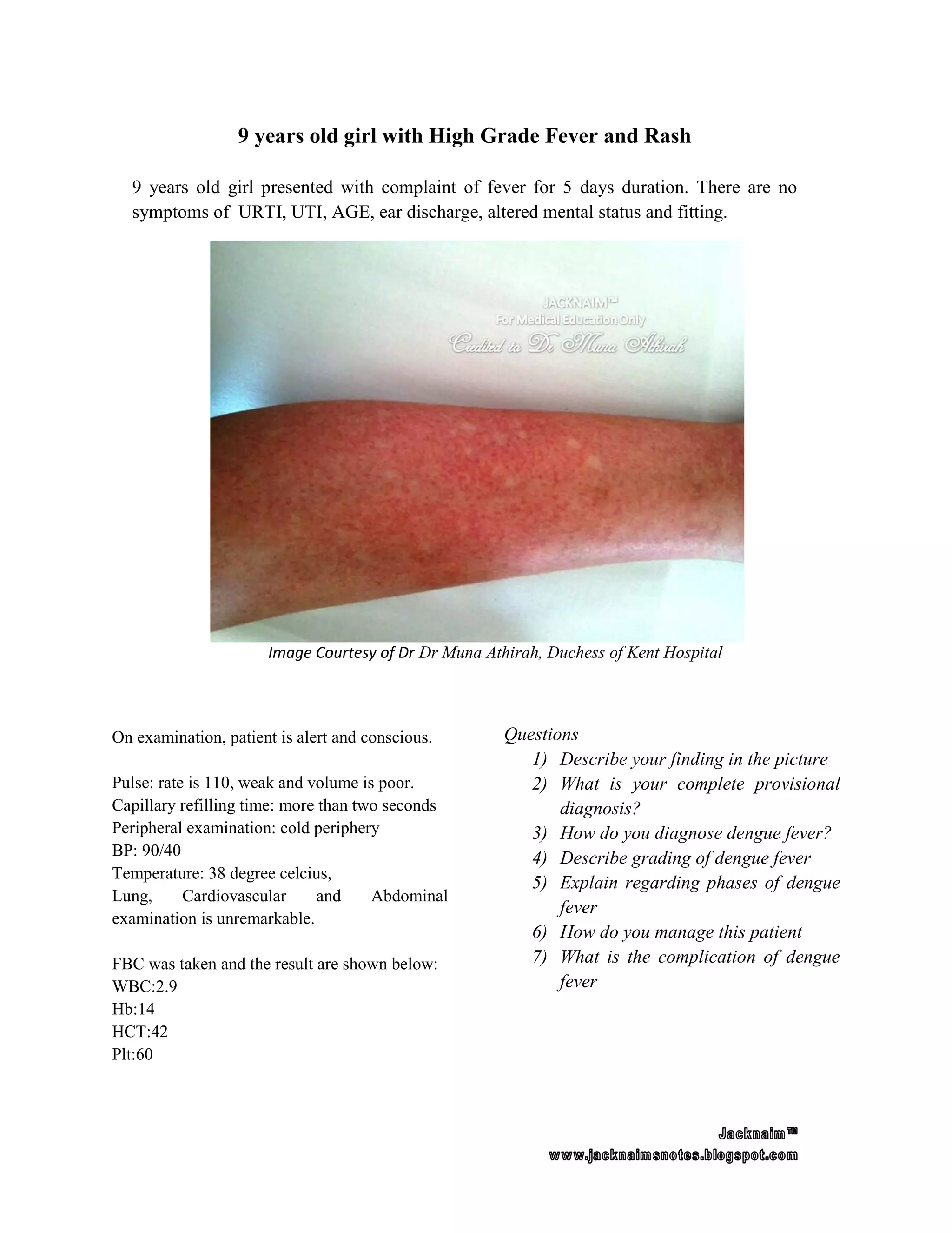 9 years old girl with high grade fever and rash | PDF