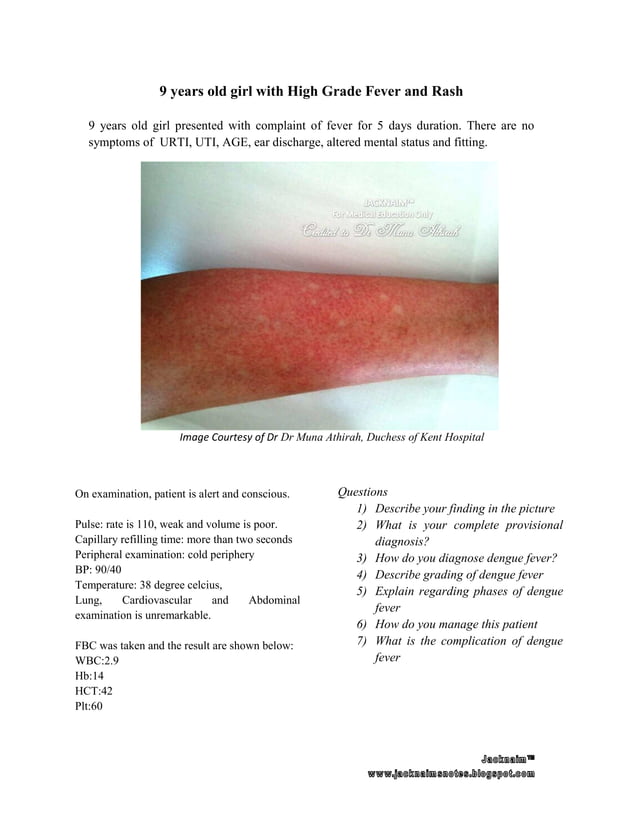 9 years old girl with high grade fever and rash | PDF
