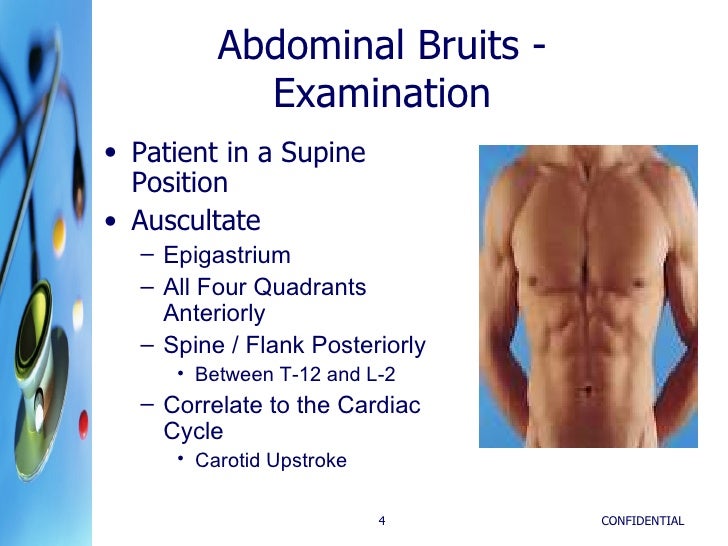 Abdominal Bruit Preso 2