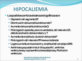 Alteraciones ElectrolíTicas En El Ecg | PPT