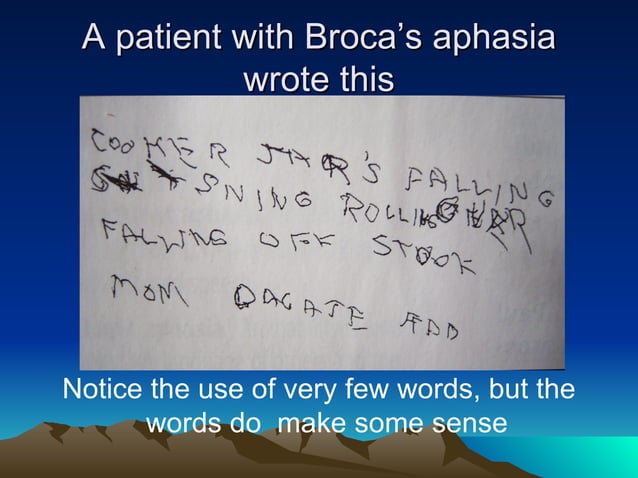 Aphasia Presentation | PPT | Brain and Nervous System Disorders ...