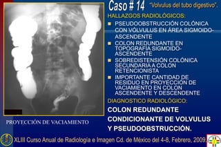 Vólvulo tubo digestivo estudios radiológicos simples contrastados TCMD ...