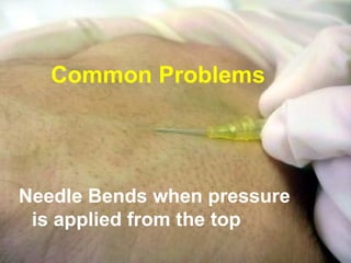 Cannula And Infection | PPS | Infectious Diseases | Diseases and Conditions