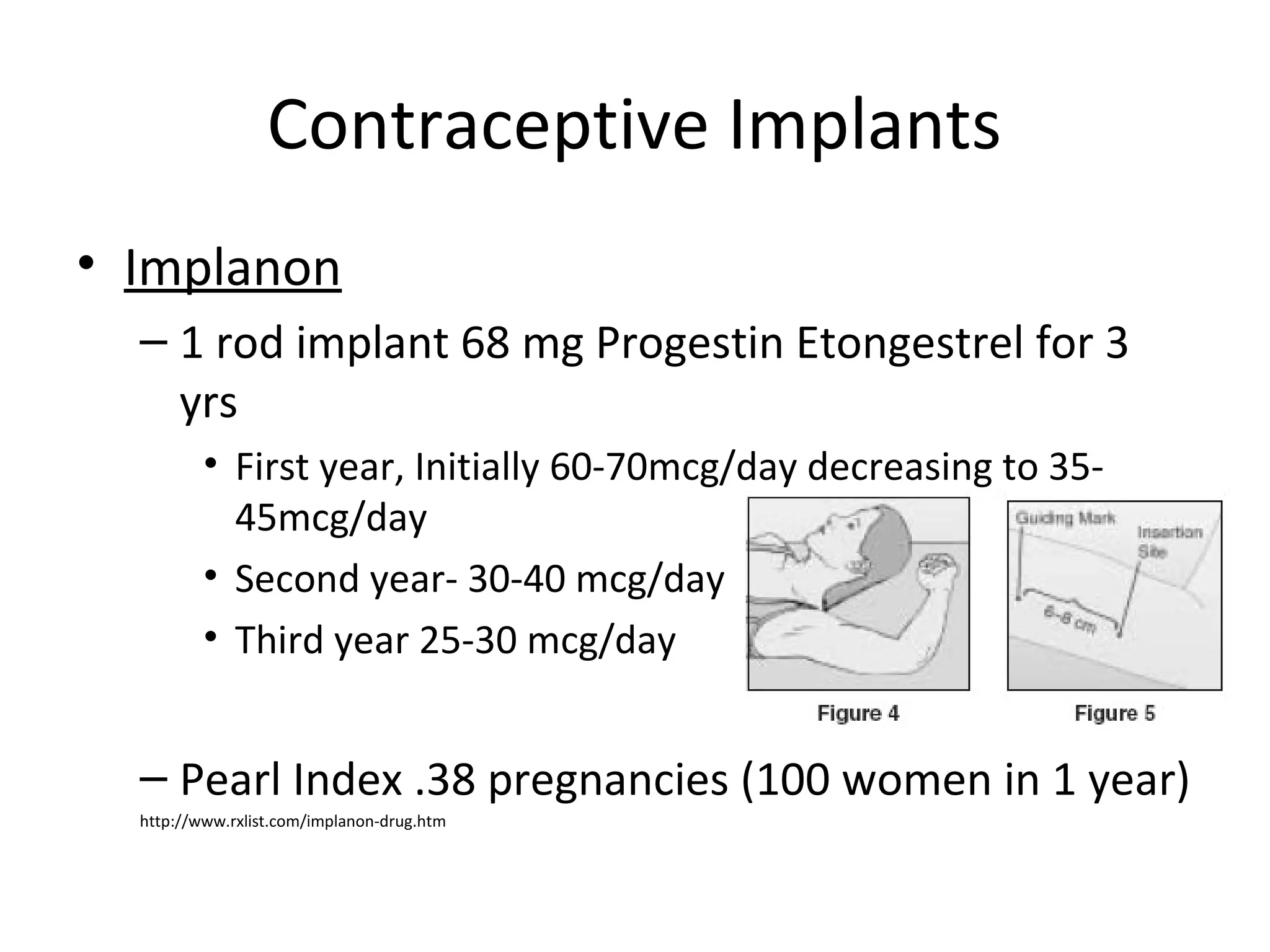 Methods of Contraception | PPT