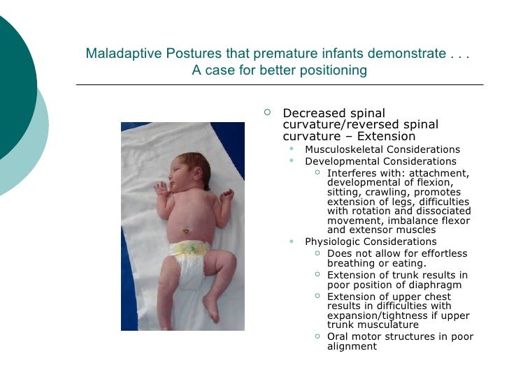 Developmental Care Lecture April 2008