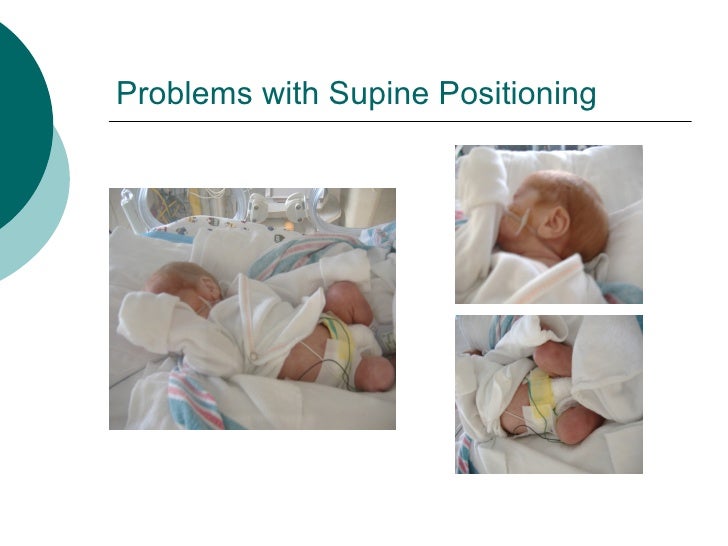 Developmental Care Lecture April 2008