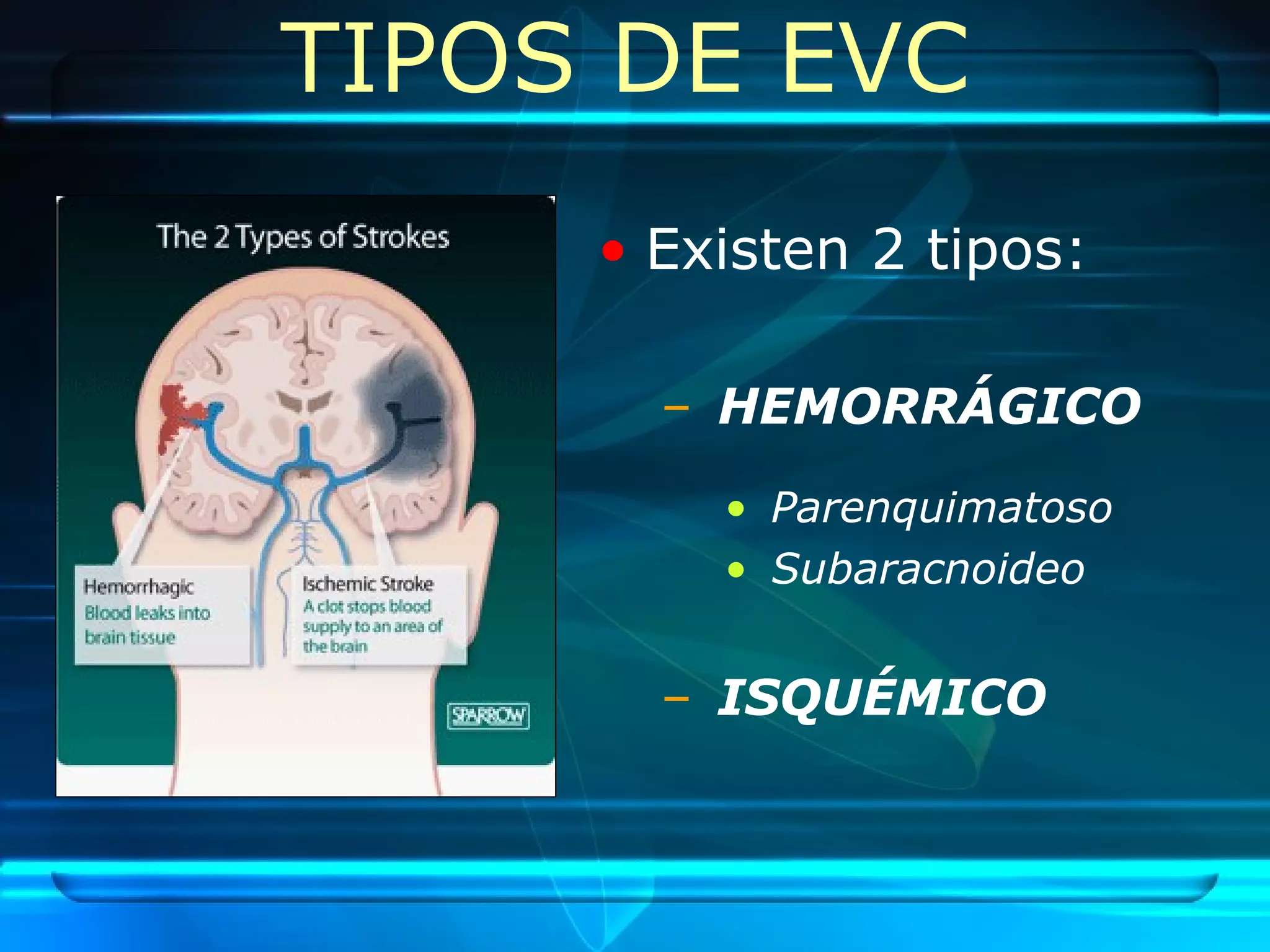 Enfermedad Vascular Cerebral Ppt