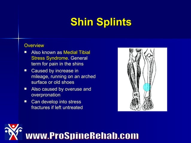 Five Most Common Running Injuries | PPT