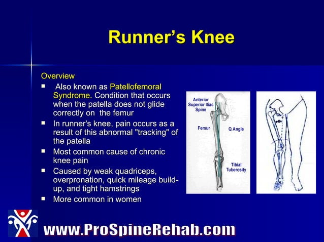 Five Most Common Running Injuries | PPT