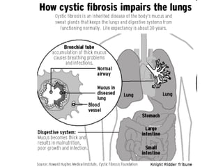 Bio 10 - Genetics Mutations | PPT