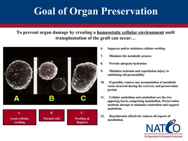 Organ Recovery & Preservation | PPT