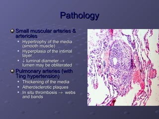 Pulmonary Hypertension 1 | PPT