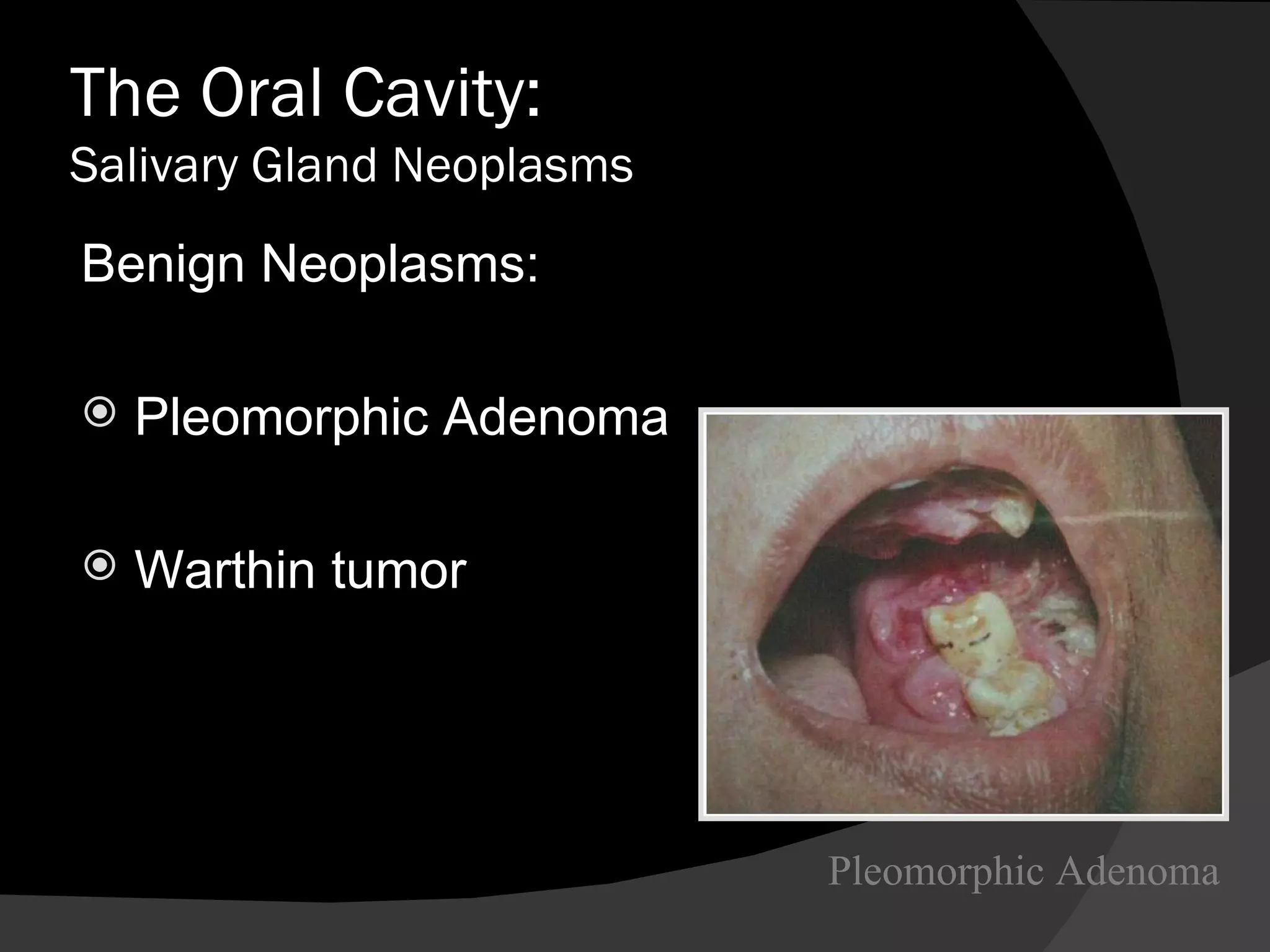 The Oral Cavity And Gastrointestinal System June 08 Xition | PPT