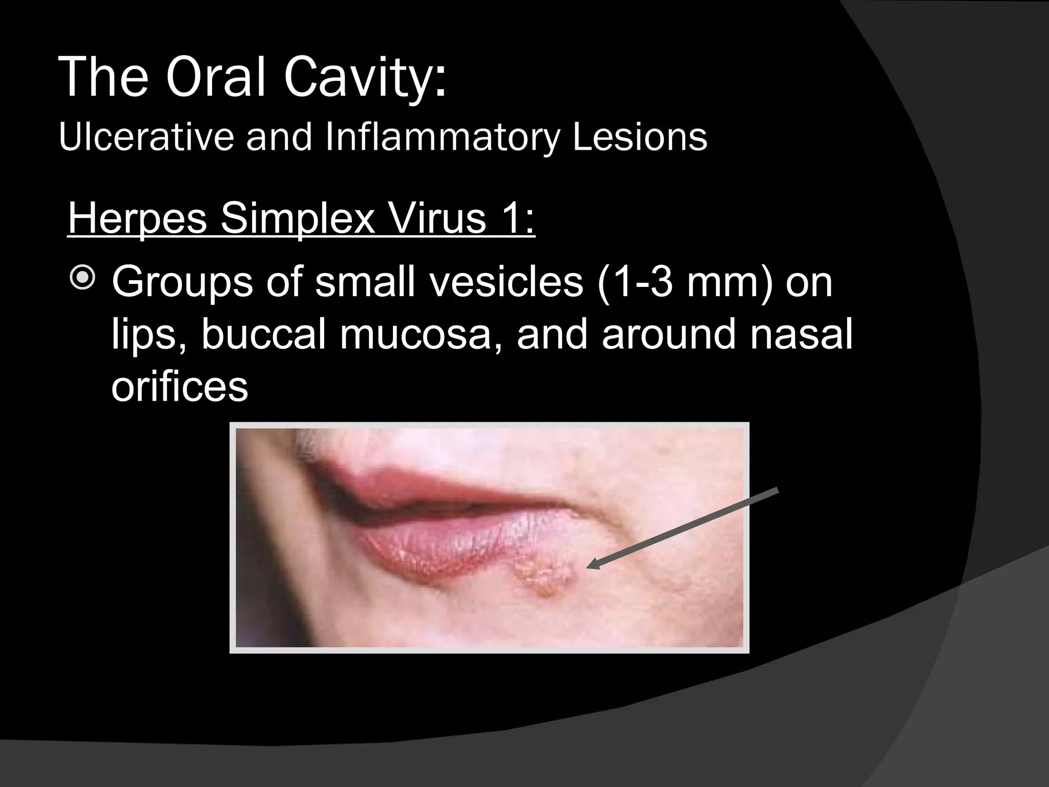 The Oral Cavity And Gastrointestinal System June 08 Xition | PPT