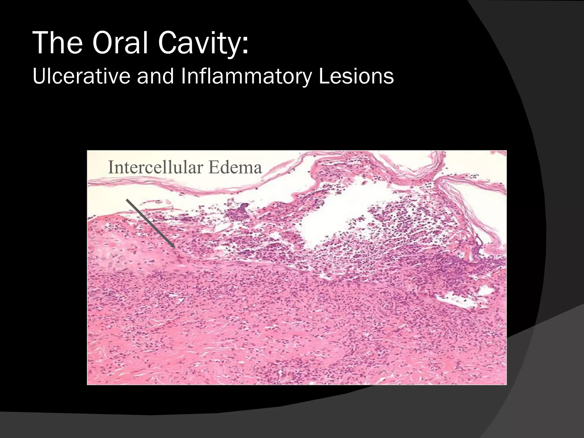 The Oral Cavity And Gastrointestinal System June 08 Xition | PPT