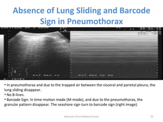 Thoracic Ultrasound For The Respiratory System In Critically Ill ...