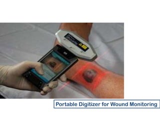 Wound Healing | PPT