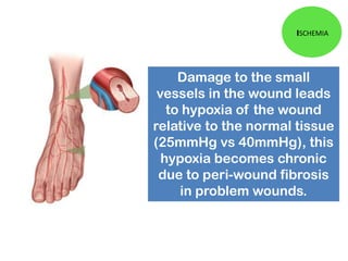 Wound Healing | PPT