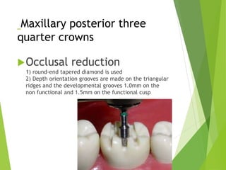posterior partial veneer crown preparation | PPTX