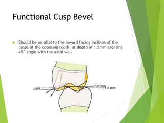 posterior partial veneer crown preparation | PPTX