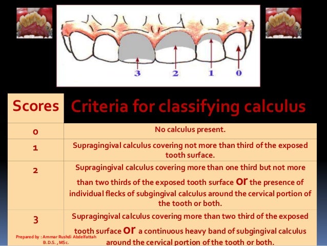 Dental Hygiene Calculus Classification