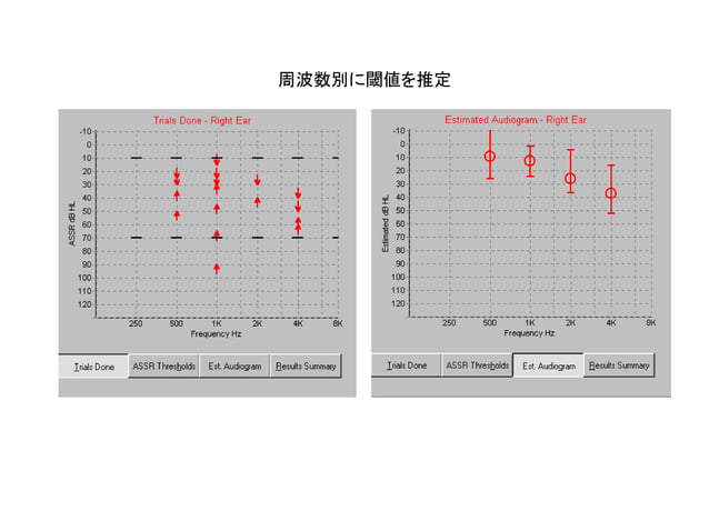 聴力測定技術講習会 ABRとASSR | PPTX | Brain and Nervous System Disorders | Diseases and Conditions