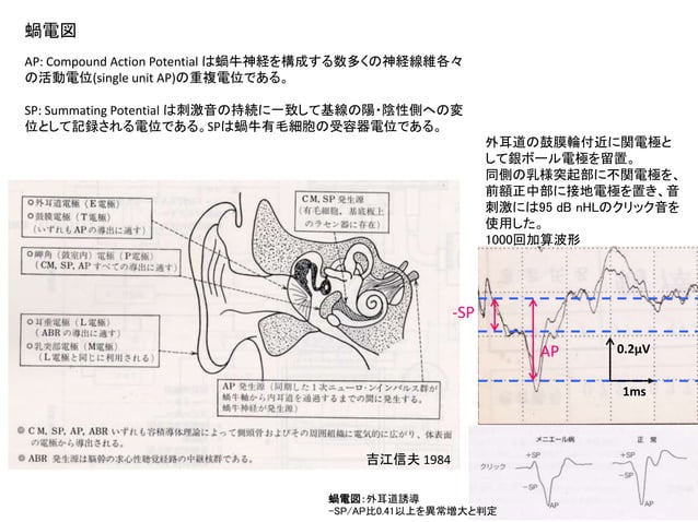 聴力測定技術講習会 ABRとASSR | PPTX | Brain and Nervous System Disorders | Diseases and Conditions