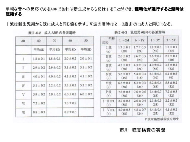Abr 新生児潜時早産 | Abr 潜時 基準値 : 聴性脳 反応 ABR 波 及 す 果 – MZPHU