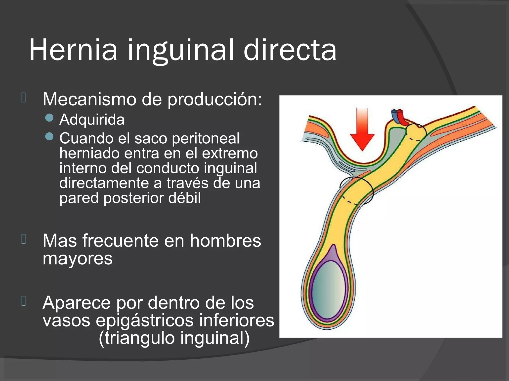 Anatomía del Ligamento Inguinal | PPT