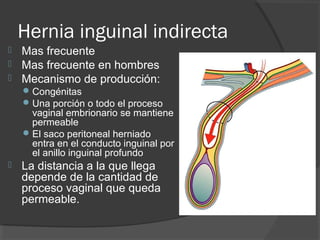 Lectura De Conducto Inguinal Vesalio, 51% OFF
