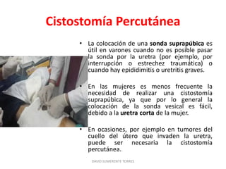 Anatomía de los Conductos Excretores de los Riñones | PPTX
