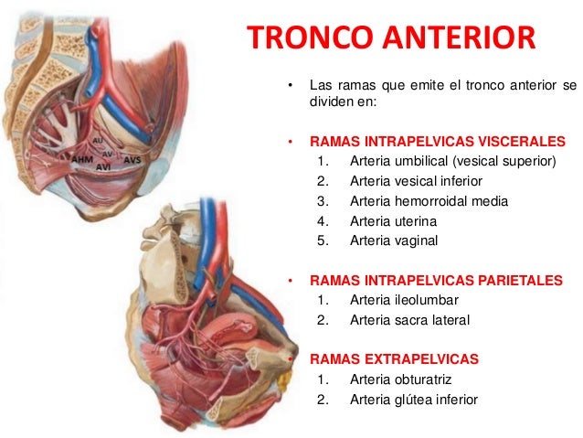 Anatomía de la Arteria Ilíaca Interna