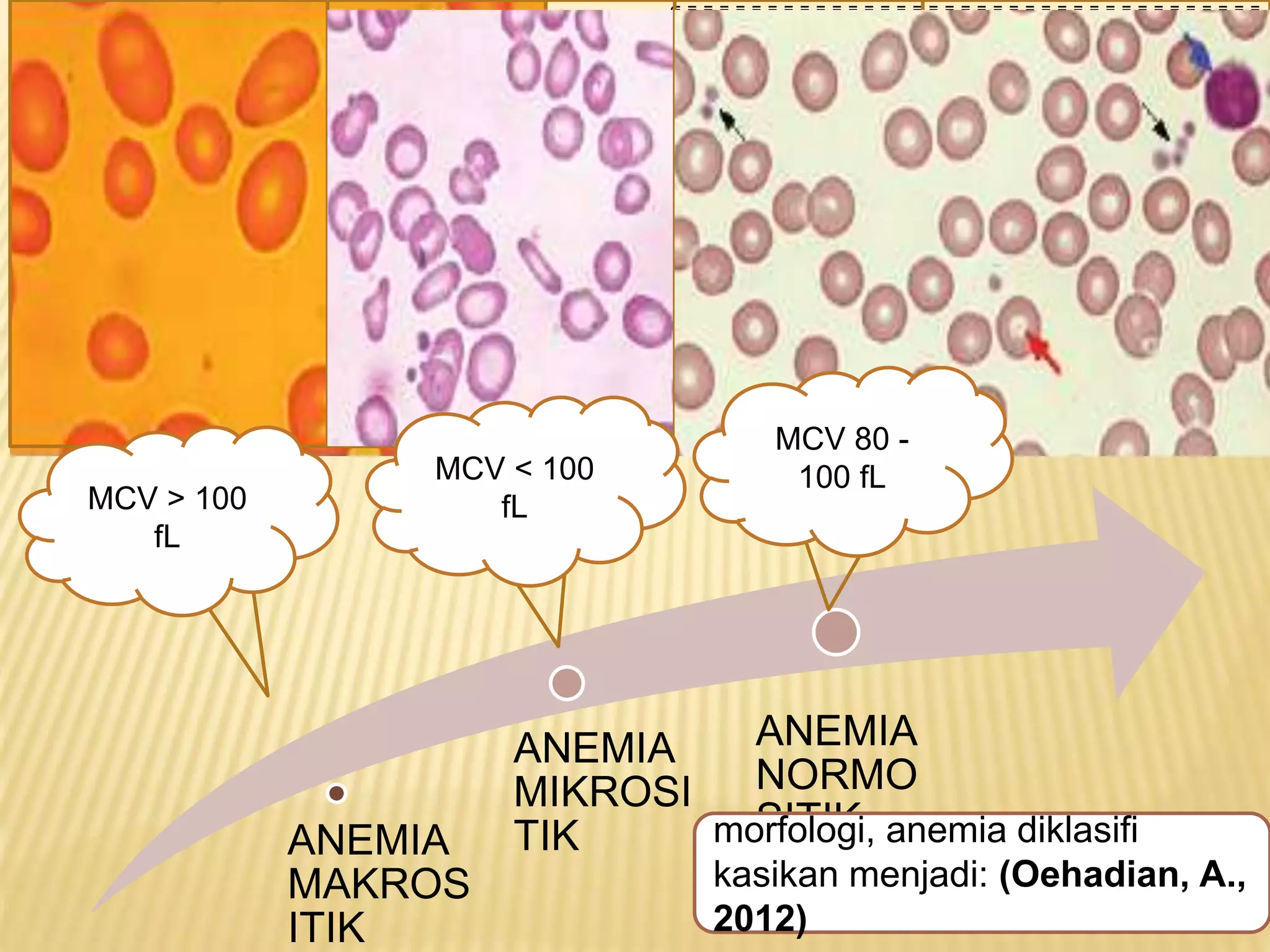A. pendekatan diagnosis anemia | PPTX
