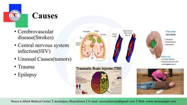 operculum syndrome | PPTX