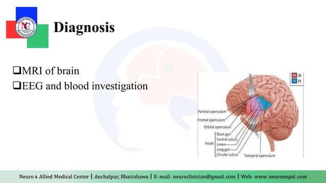 operculum syndrome | PPTX
