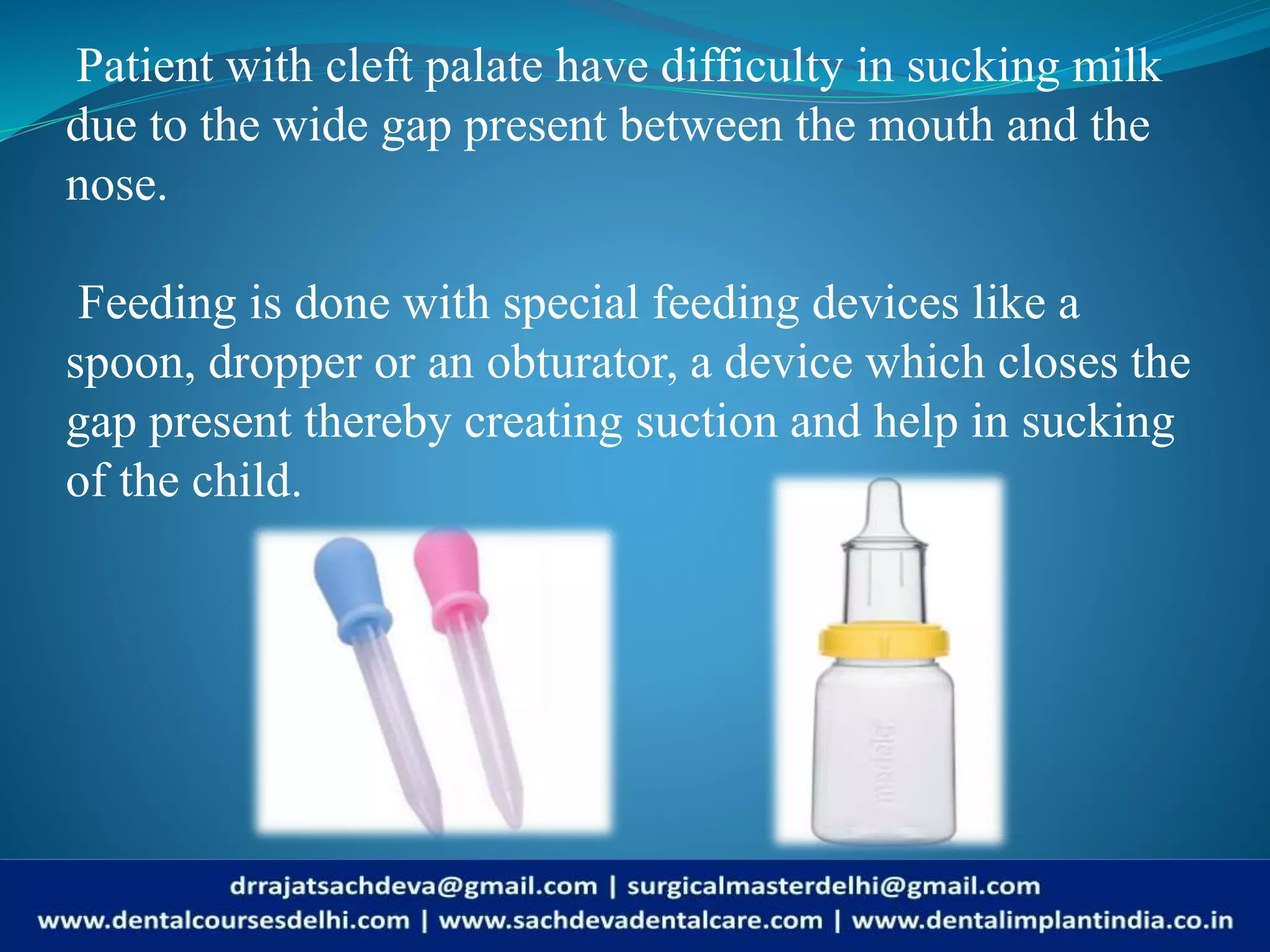 Cleft lip/Cleft Palate | Cleft Lip, Cleft Palate: What is a cleft lip ...