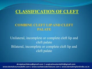 Cleft lip/Cleft Palate | Cleft Lip, Cleft Palate: What is a cleft lip ...
