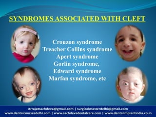 Cleft lip/Cleft Palate | Cleft Lip, Cleft Palate: What is a cleft lip ...